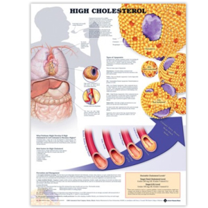 HIGH CHOLESTEROL CHART 51 X 66CM RIGID Each | Livingstone International